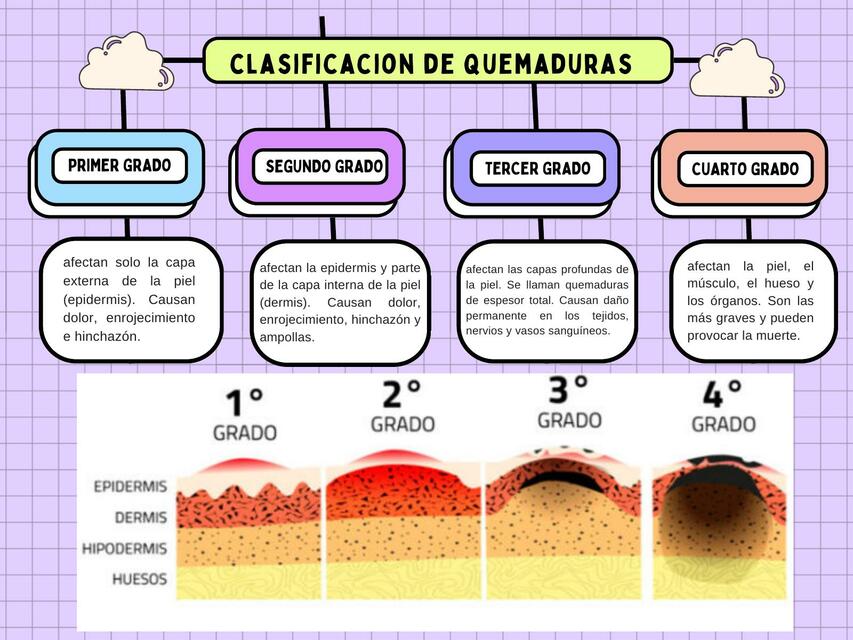 CLASIFICACION DE QUEMADURAS | Yamileth | uDocz