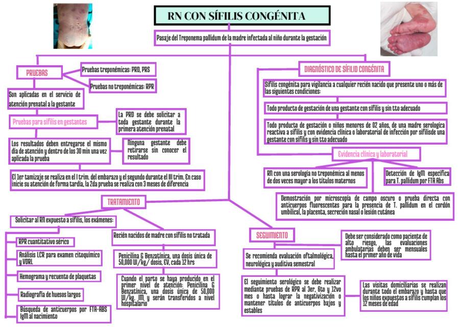 Flashcards de Mapa conceptual de sífilis congénita en el RN | Por nursing.cvc | uDocz