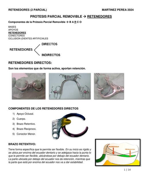 RETENEDORES - PRÓTESIS PARCIAL REMOVIBLE | Mauro Martinez | uDocz