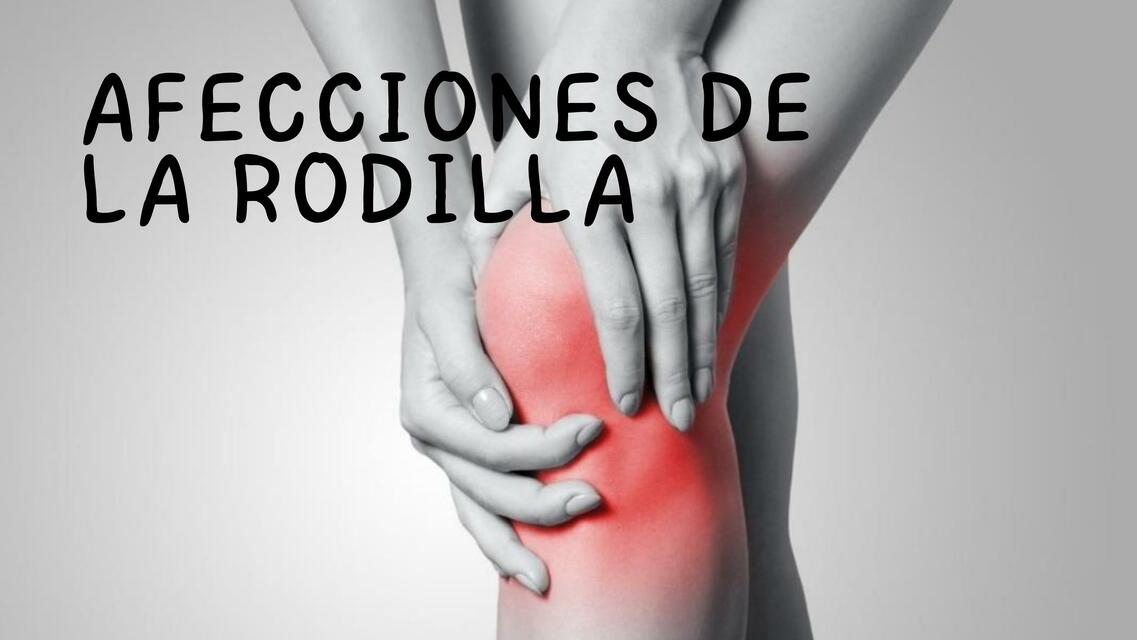 Flashcards de AFECCIONES DE LA RODILLA GRUPO 3 | Por Jufrania | uDocz
