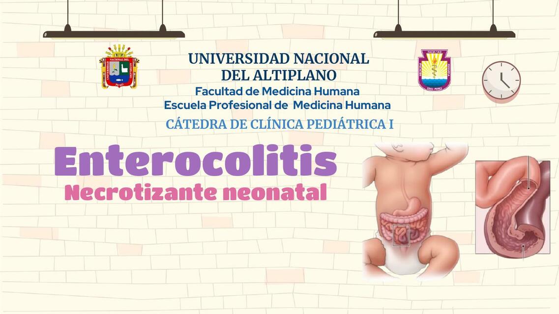Enterocolitis Necrotizante | SINTIA TATIANA - Medyversos | uDocz