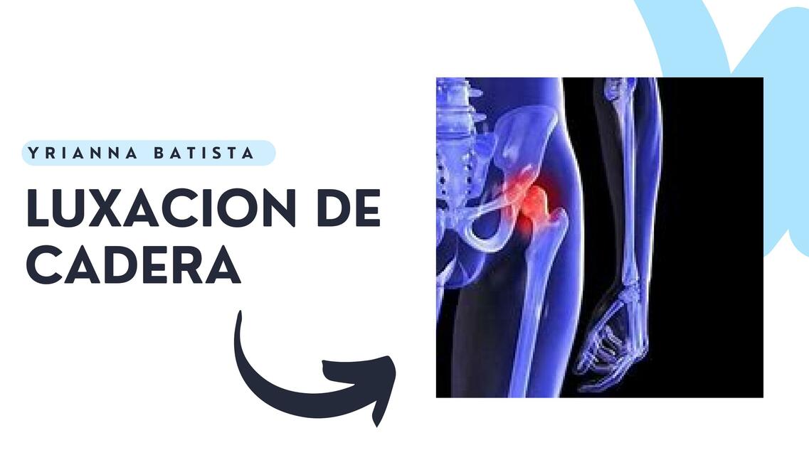 luxacion de cadera | Dra. Batista | uDocz