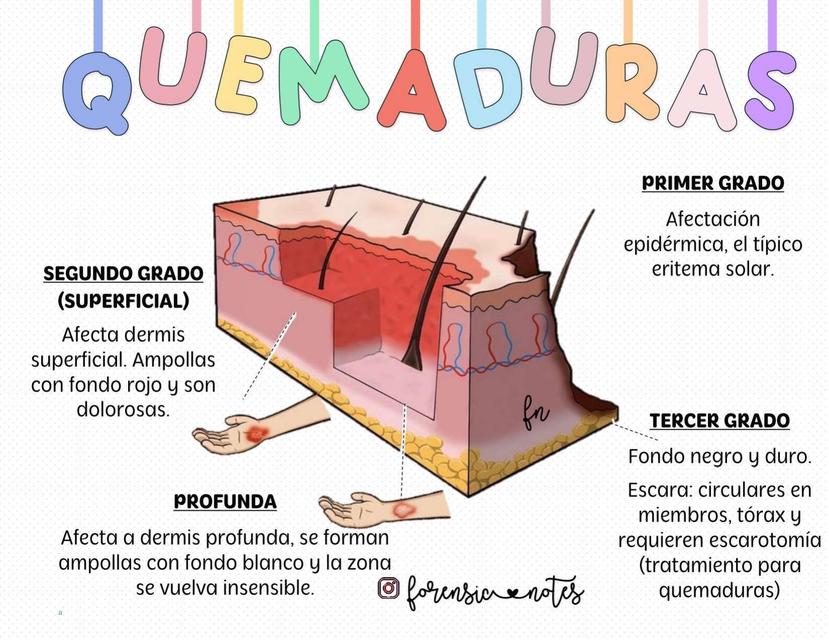 Diagrama De Quemadura De Tercer Grado HOSPITAL DEL NIÑO DOCTOR JOSÉ