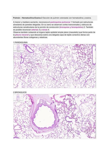 Flashcards de PULMON resumen histo | Por DANIEL LEVI | uDocz