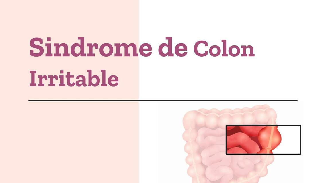 Sindrome de colon irritable o colitis - Medicina familiar | GuiasMed ...
