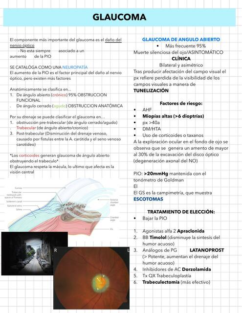 GLAUCOMA | Emiliano | uDocz