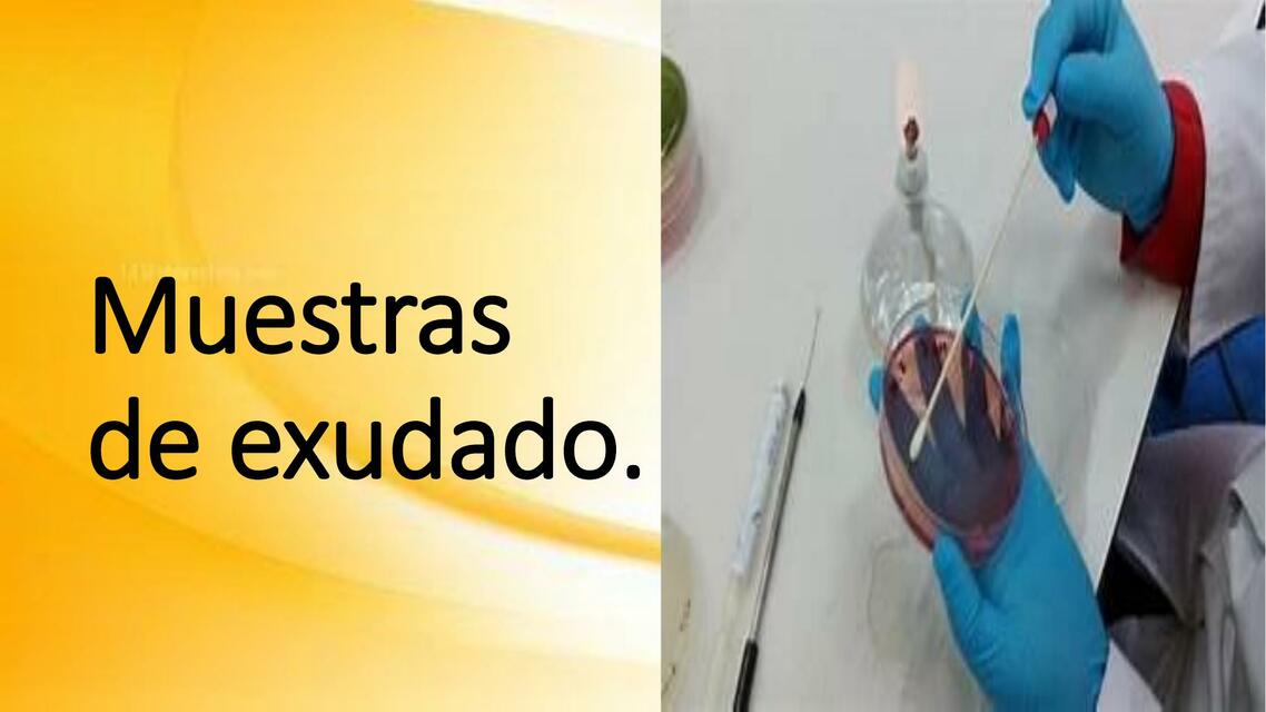 Muestras de exudado | Leonel Jimenez | uDocz