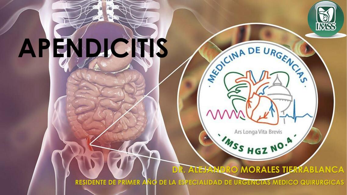 APENDICITIS | jose roberto | uDocz