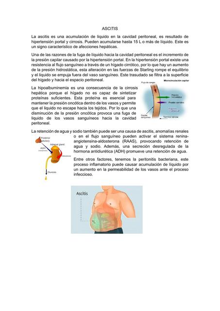 ASCITIS | Himanol Ramirez Olivares | uDocz