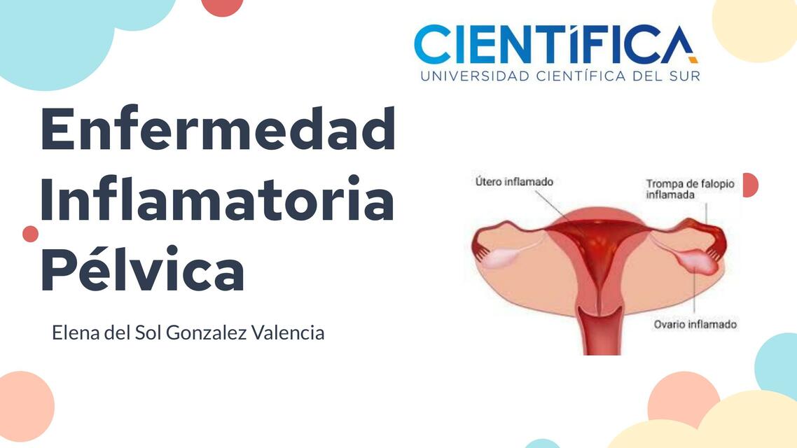 Infeccion pelvica inflamatoria pptx | Elena del Sol González Valencia ...