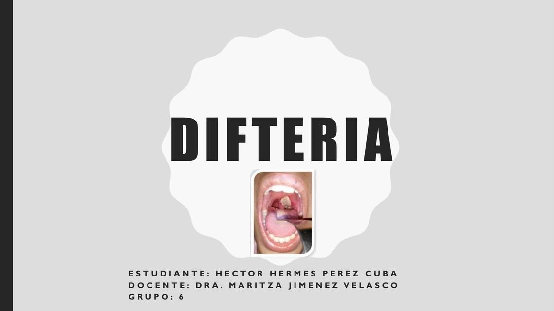 Resúmenes de Difteria | Descarga apuntes de Difteria