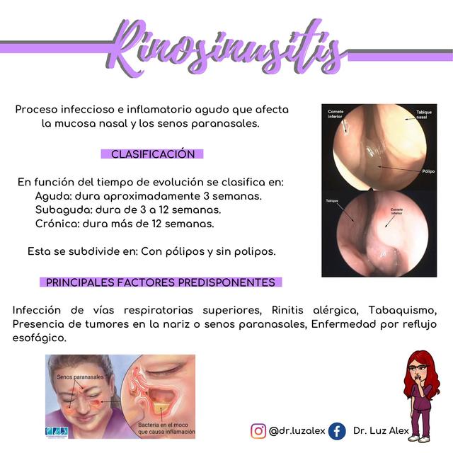 RINOSINUSITIS | Dra. Xanis | uDocz