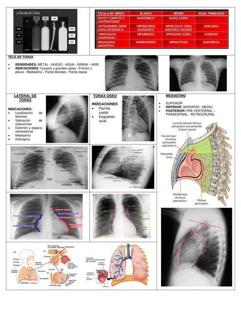 IMAGENES 2 PARCIAL | SnoopyMed | uDocz