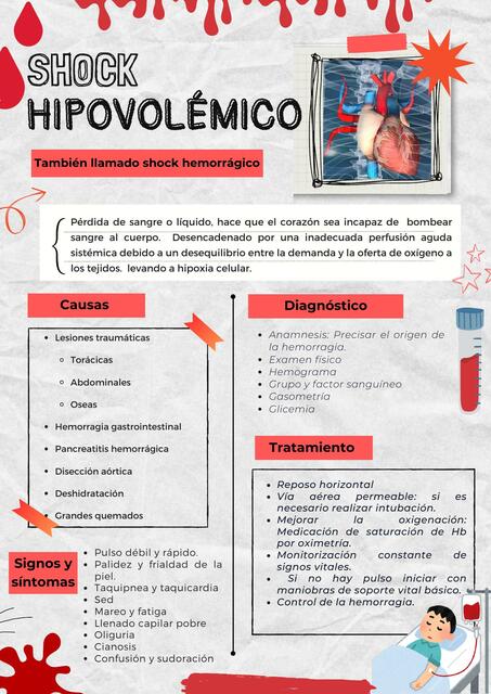 Shock hipovolémico | Nancy A3C | uDocz