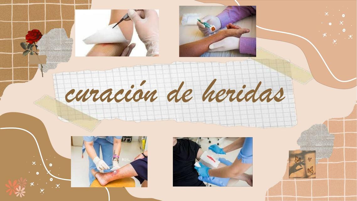 Curacion de heridas | Aura Ester Peréz Rada | uDocz