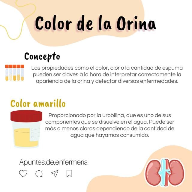 Color de la Orina | Apuntes.de.enfermeria | uDocz