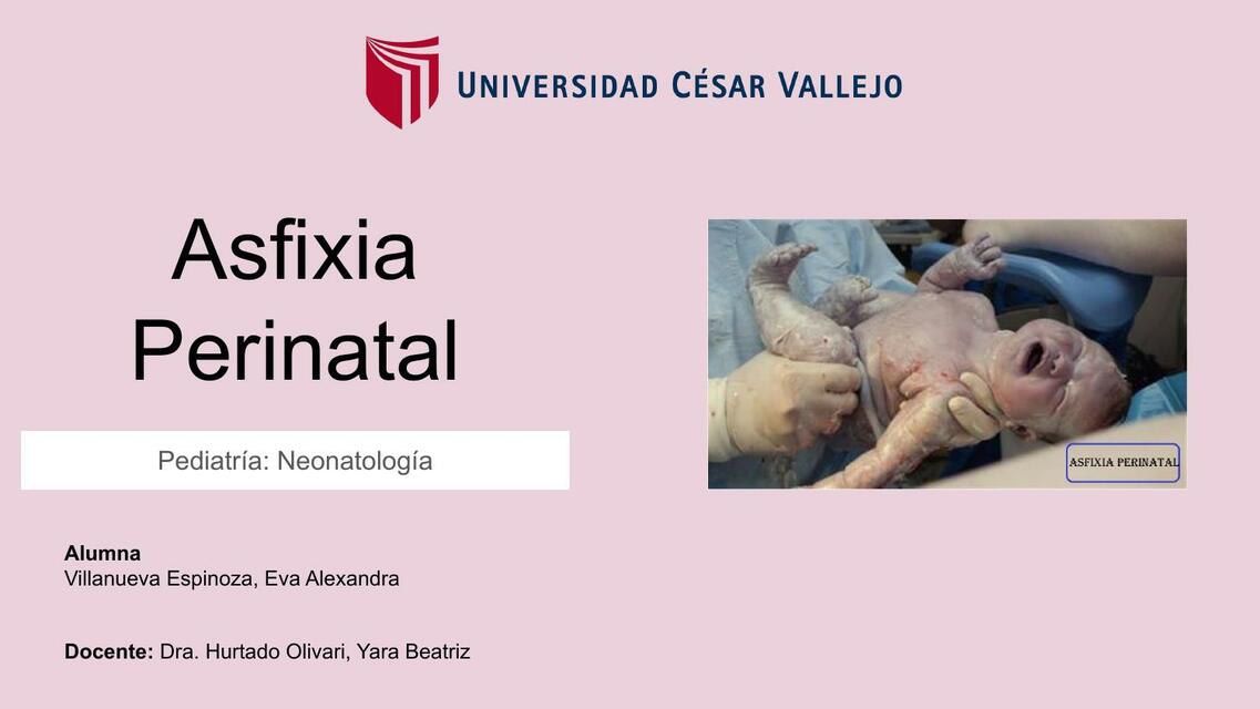 Asfixia Perinatal 1 | Alexandra | uDocz