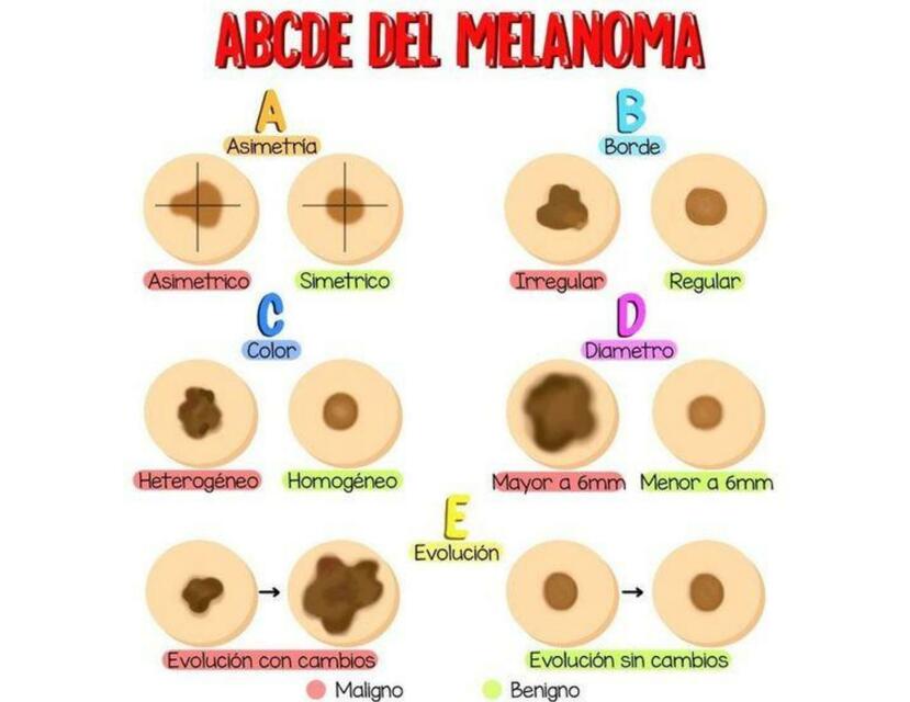 ABCDE del melanoma | fraii | uDocz