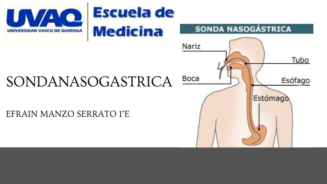 SONDA NASOGASTRICA | Efrain Manzo | uDocz