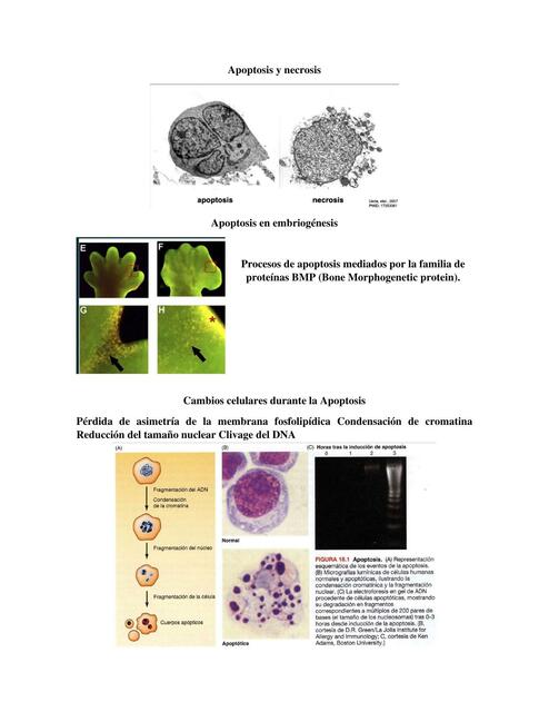 Apoptosis y necrosis | Sharay Sofia | uDocz