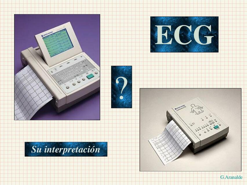 ECG normal | Donald michel | uDocz