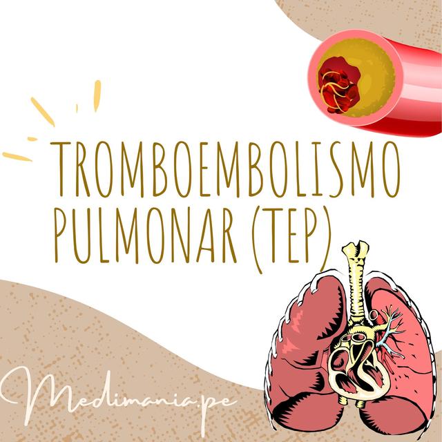 Tromboembolismo pulmonar (TEP) | Medimania.pe | uDocz