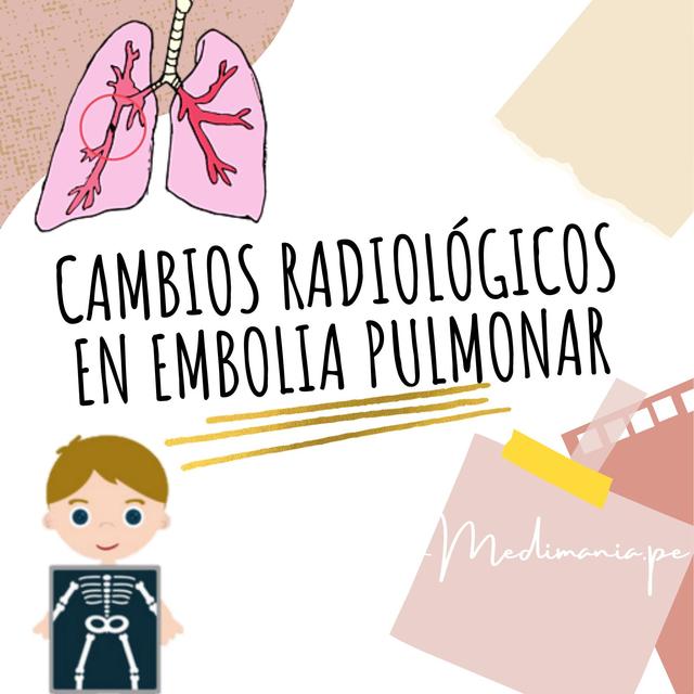 CAMBIOS RADIOLÓGICOS EN EMBOLIA PULMONAR | Medimania.pe | uDocz