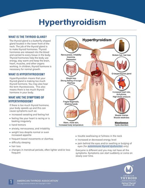 hyperthyroidism | Lizeth Ubario | uDocz