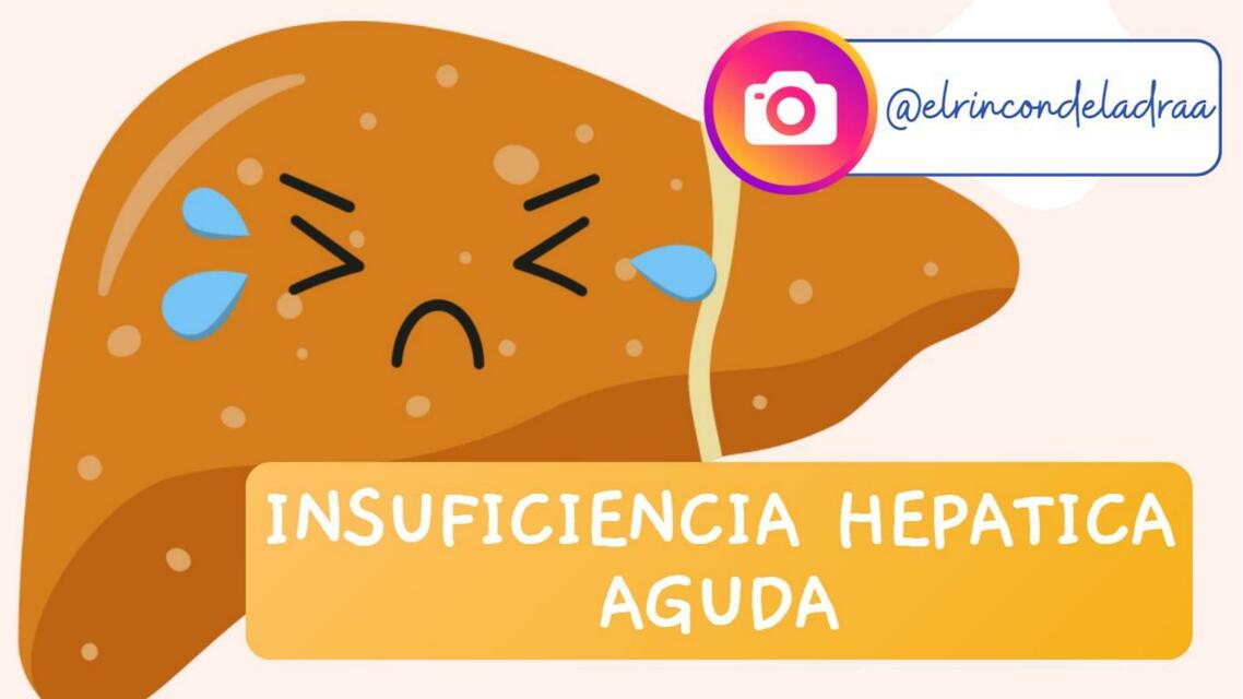 Flashcards de Insuficiencia hepatica aguda | Por uDocz | uDocz