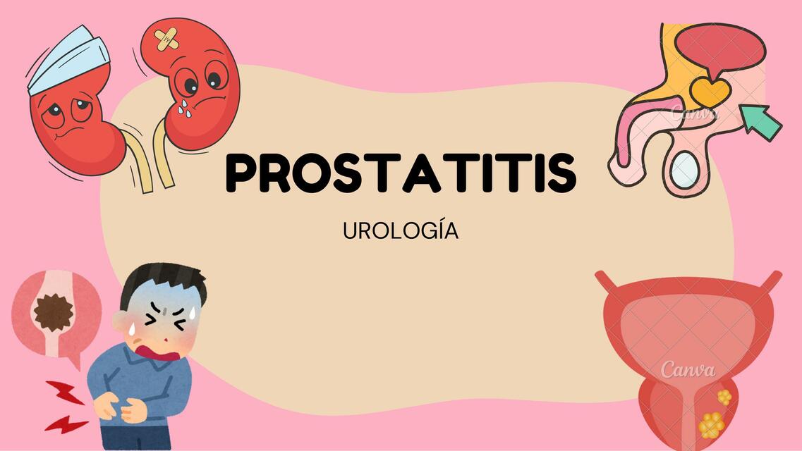 PROSTATITIS | ThinkMed | uDocz