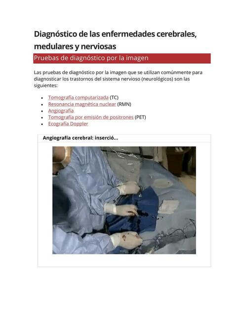 Flashcards de Diagnóstico de las enfermedades cerebrales medular | Por Aura Ester Peréz Rada | uDocz