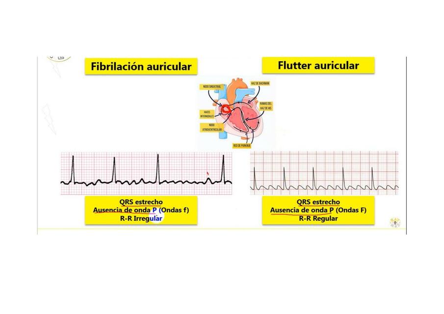 ARRITMIA | Sofia Armas | uDocz