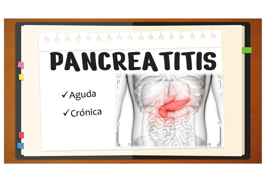 PANCREATITIS AGUDA Y CRONICA | Doctor_teco | uDocz