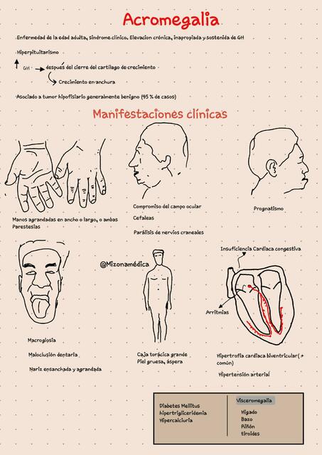 Acromegalia | Mizonamédica | uDocz