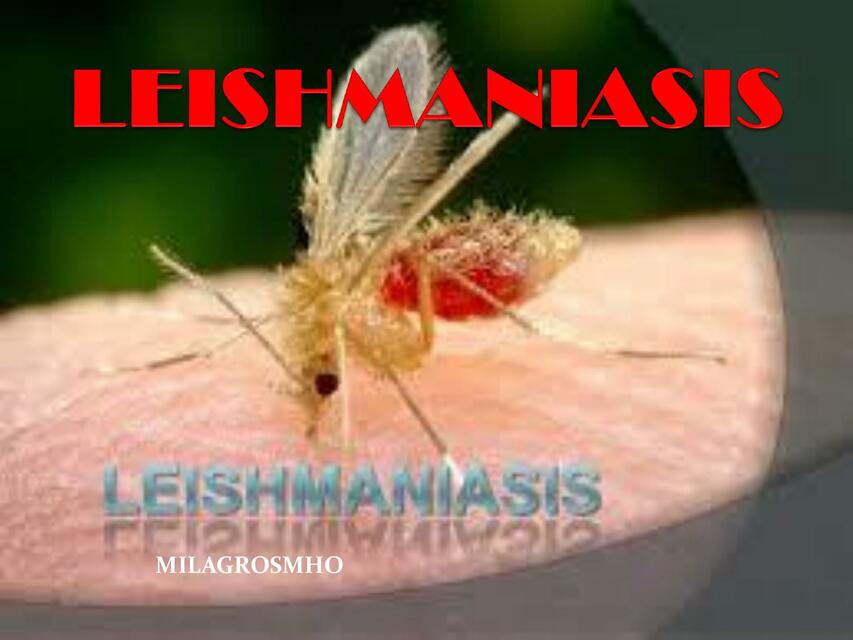 LEISHMANIASIS pp | Medaly Hancoo Ortiz | uDocz