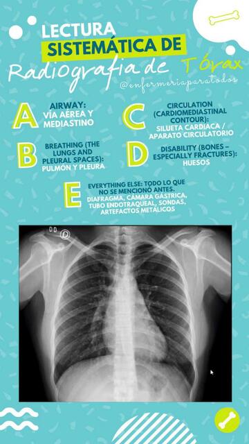 ABCDE EN RADIOGRAFIA | YUDOC.ORG | uDocz
