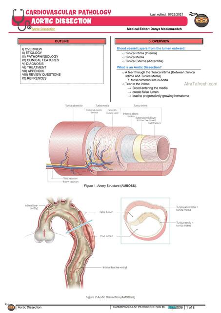 Aortic Dissection Etiology Pathophysiology Diagnos | Omar Mendo | uDocz