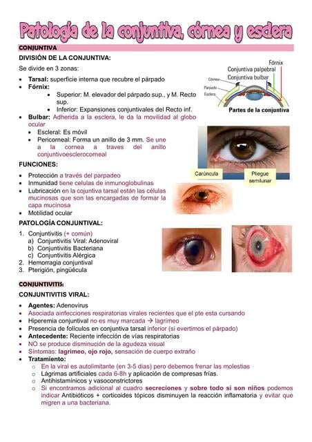 Patología de la conjuntiva, esclera y córnea | Notas médicas | uDocz