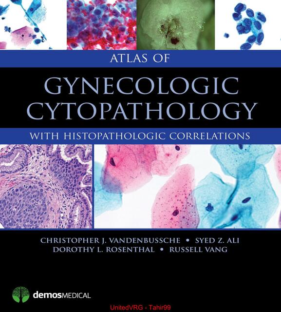 Atlas of Gynecologic Cytopathology | Bárbara | uDocz
