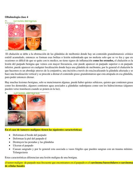 Oftalmología clase 4 | Paola Rijo | uDocz