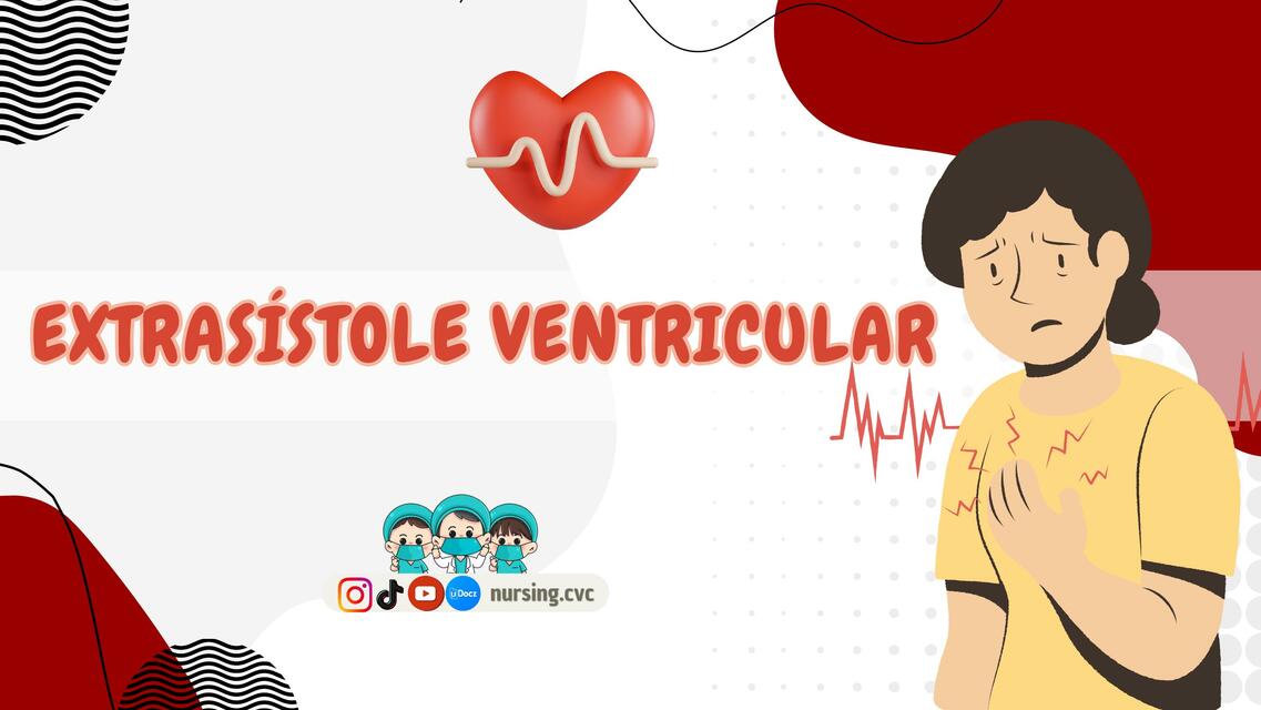 EXTRASÍSTOLE VENTRICULAR | nursing.cvc | uDocz