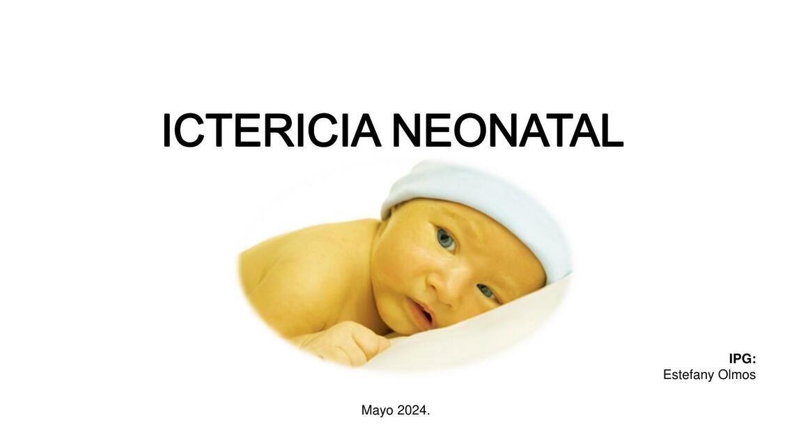 ICTERICIA NEONATAL | Estefany Olmos | uDocz