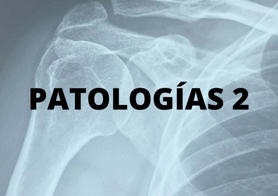 PATOLOGÍAS RX (algunos signos radiológicos de IC, ENFISEMA, EDEMA ...