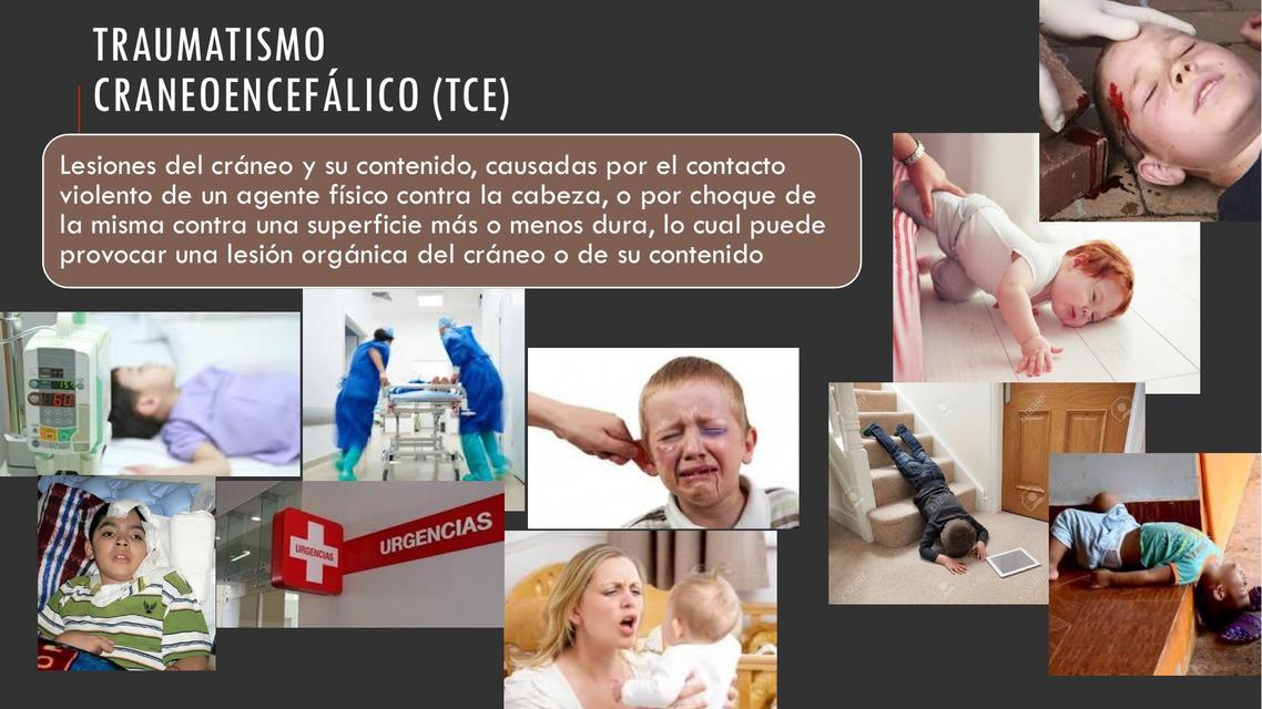 TRAUMATISMO CRANEOENCEfáLICO EN PEDIATRIA | Salud | Anatomía | uDocz TRAUMATISMO CRANEOENCEfáLICO EN PEDIATRIA | Salud | Anatomía | uDocz