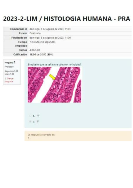 Histología P1 - Tejido epitelial 2023.2 | Briggitte Yamilé Suarez Esteban | uDocz