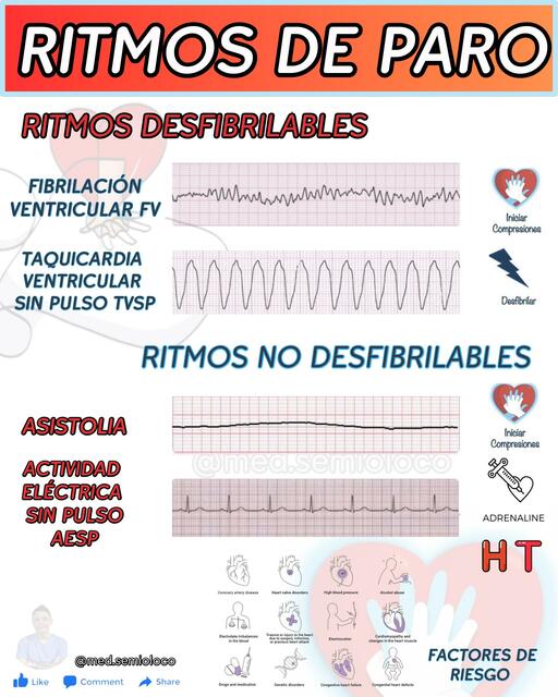 RITMOS DE PARO CARDÍACA | Víctor Rodriguez Botero - @med.semioloco | uDocz