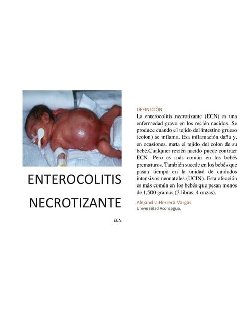 enterocolitis necrotizante | Alejandra | uDocz