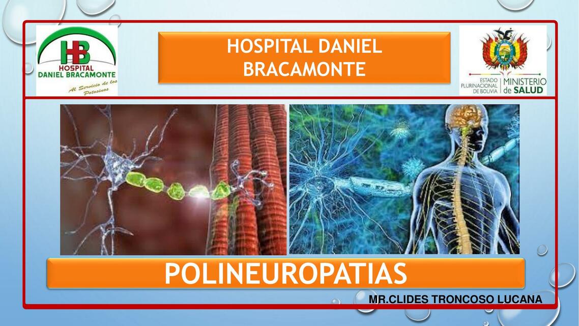 POLINEURITIS | Clides Troncoso | uDocz